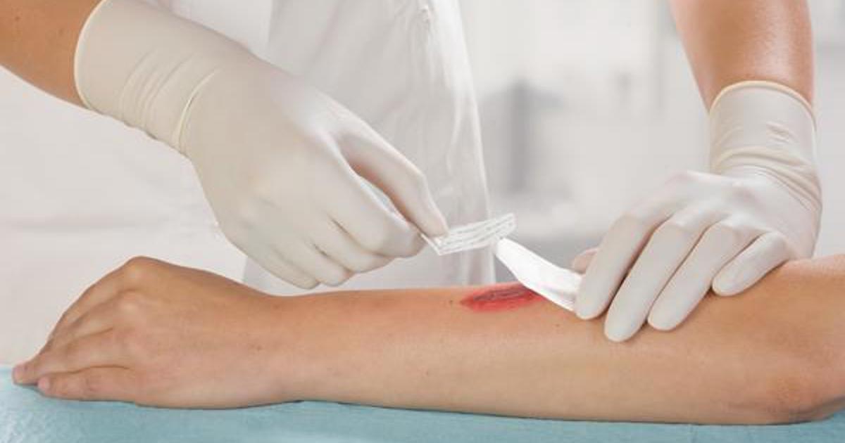 Wunden optimal versorgt | Der Rheintaler